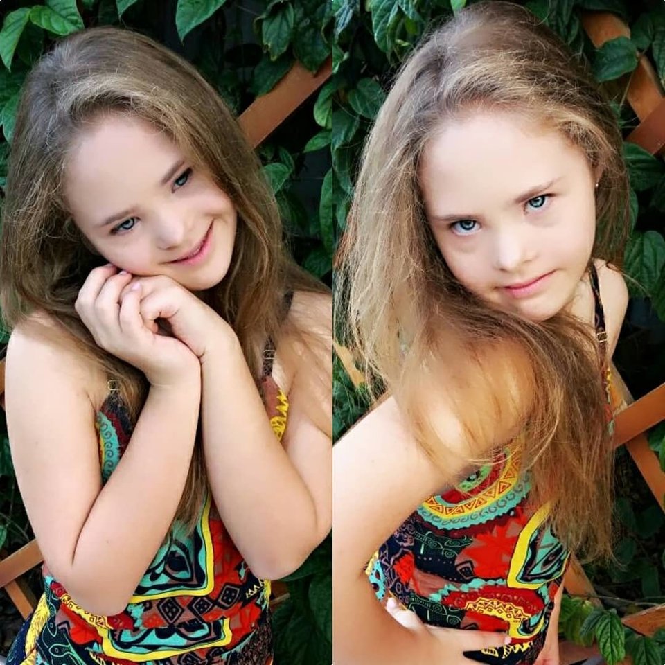 Dauno sindromą turintį modelį lydi pavydėtina sėkmė: didžiausias ...