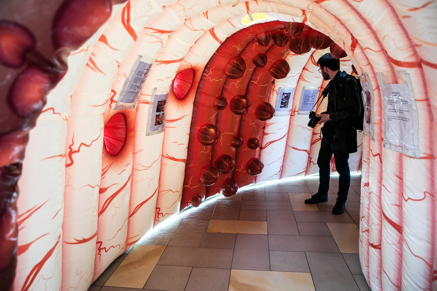 Neįprasta patirtis – kviečia išvysti, kaip storosios žarnos vėžys ...