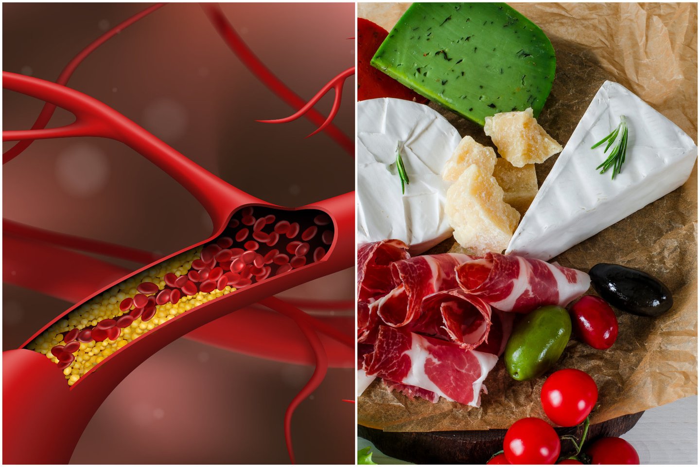 Tyrimas parodė: šis maisto produktas mažina cholesterolio kiekį kraujyje