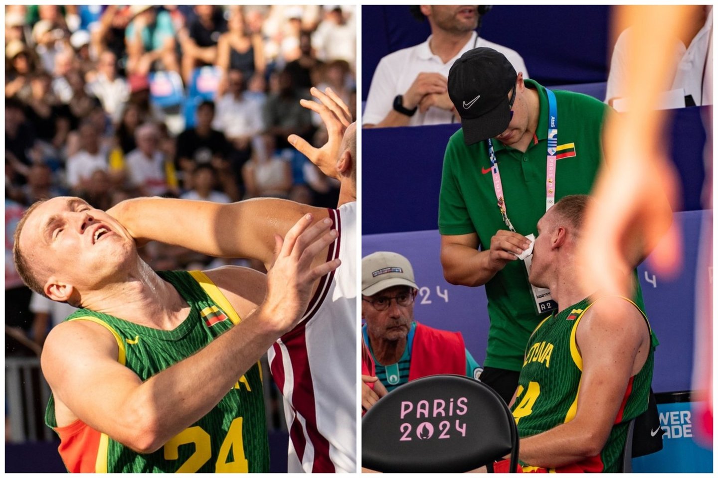 Mėlynę po akimi „dovanų“ nuo latvio gavęs A. Pukelis atviravo apie ...