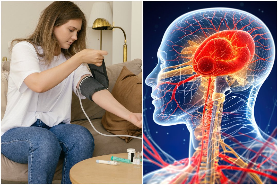 Įsidėmėkite: 5 patarimai, kurie padės išvengti insulto